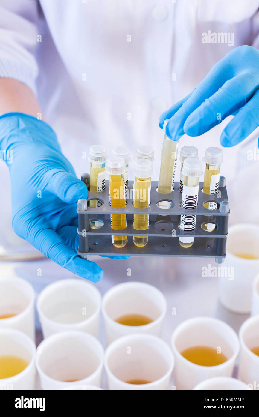 Urine analysis in laboratory Stock Photo - Alamy