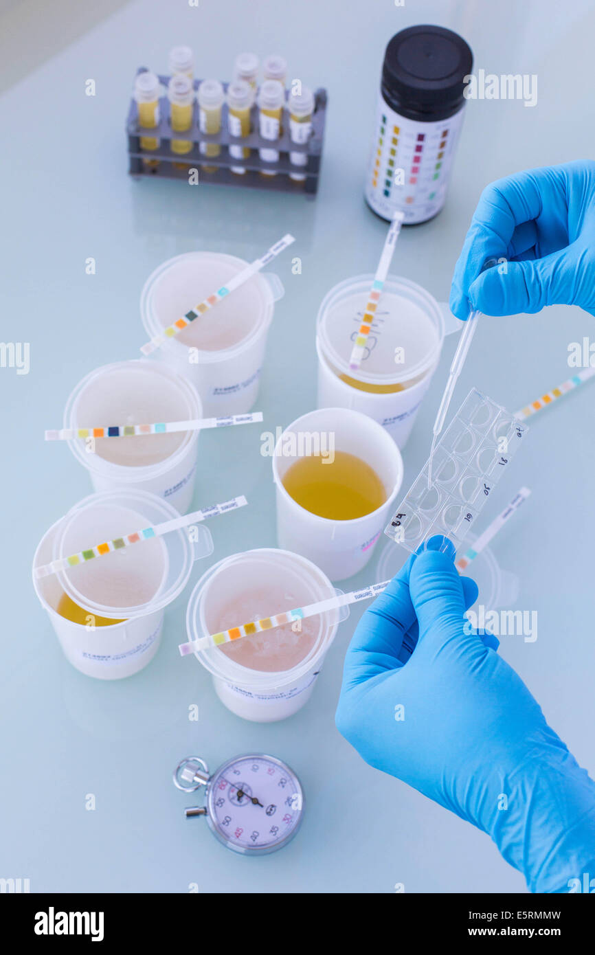 Urine analysis in laboratory Stock Photo - Alamy