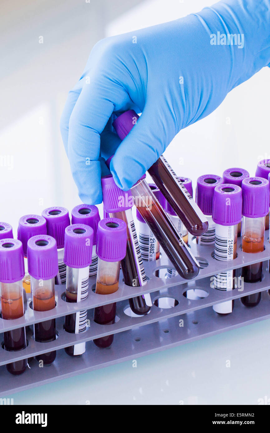 Blood sample barcode hi-res stock photography and images - Alamy