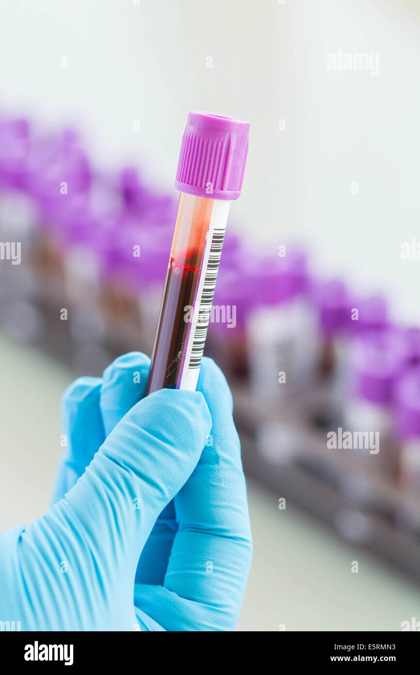 Blood sampling hi-res stock photography and images - Alamy