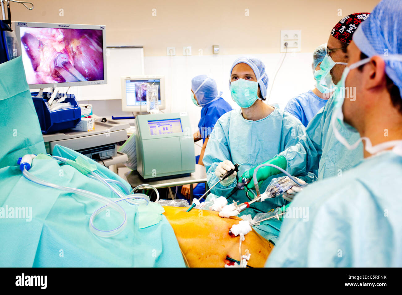 Liver surgery laparoscopy hi-res stock photography and images - Alamy