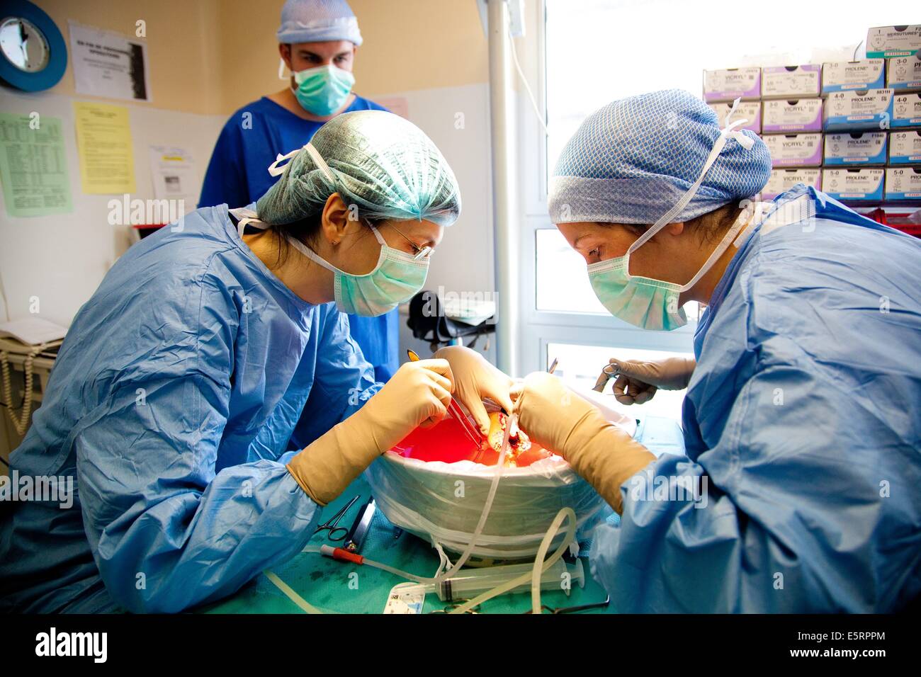 Partial removal of a liver from a living donor by laparoscopy for a ...