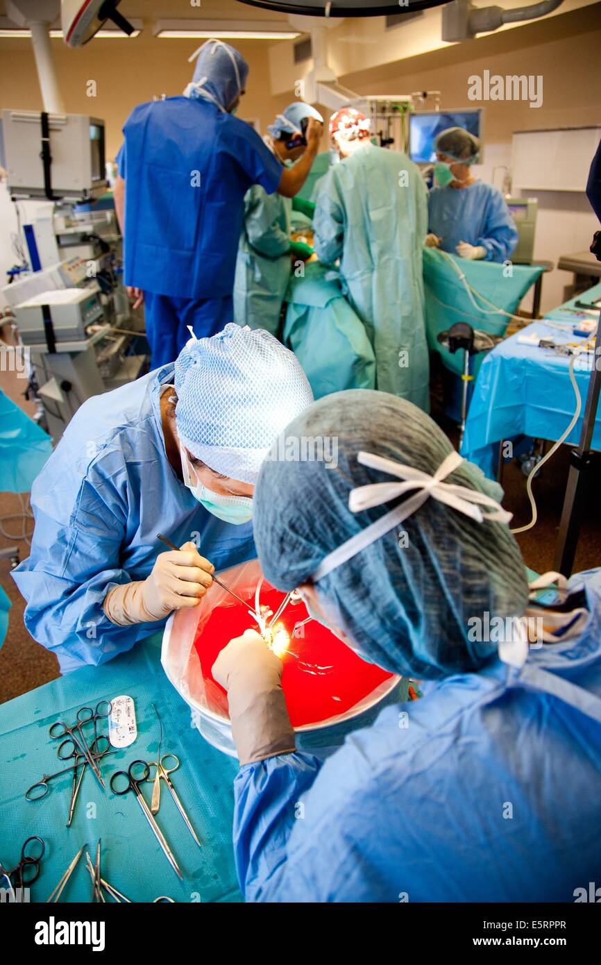 Partial removal of a liver from a living donor by laparoscopy for a ...