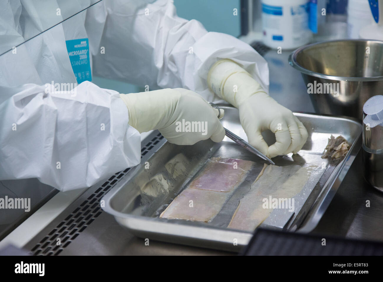 Preparation of a skin donation in a cleanroom before preservation, cell ...