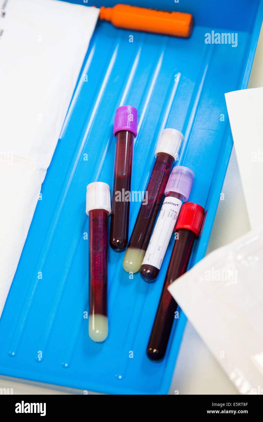 Medical samples hi-res stock photography and images - Alamy