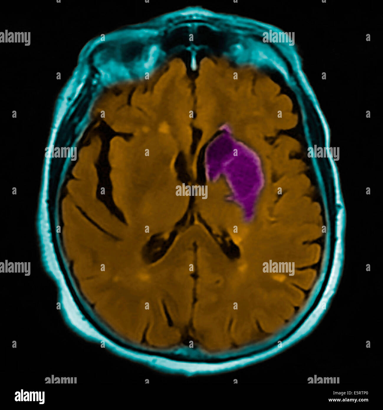Radiographic And Magnetic Resonance Imaging Identification