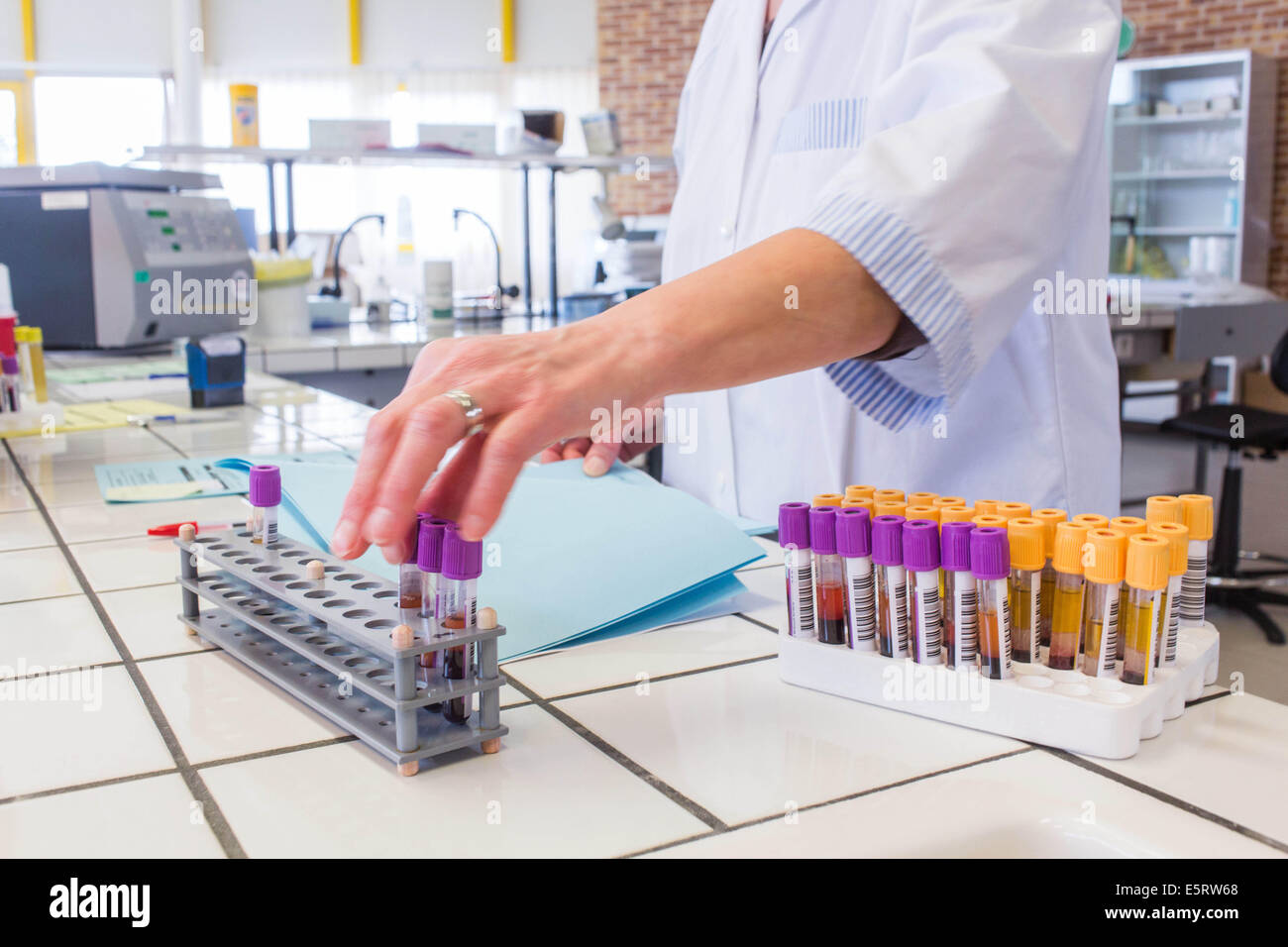 Calcium blood test hi-res stock photography and images - Alamy