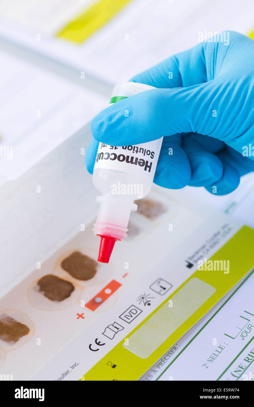 Hemoccult test in laboratory Stock Photo - Alamy