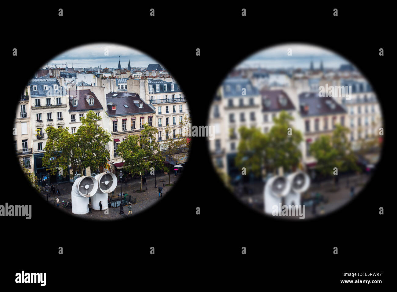 At right, patient's-eye view of buildings, in a patient with blurred ...