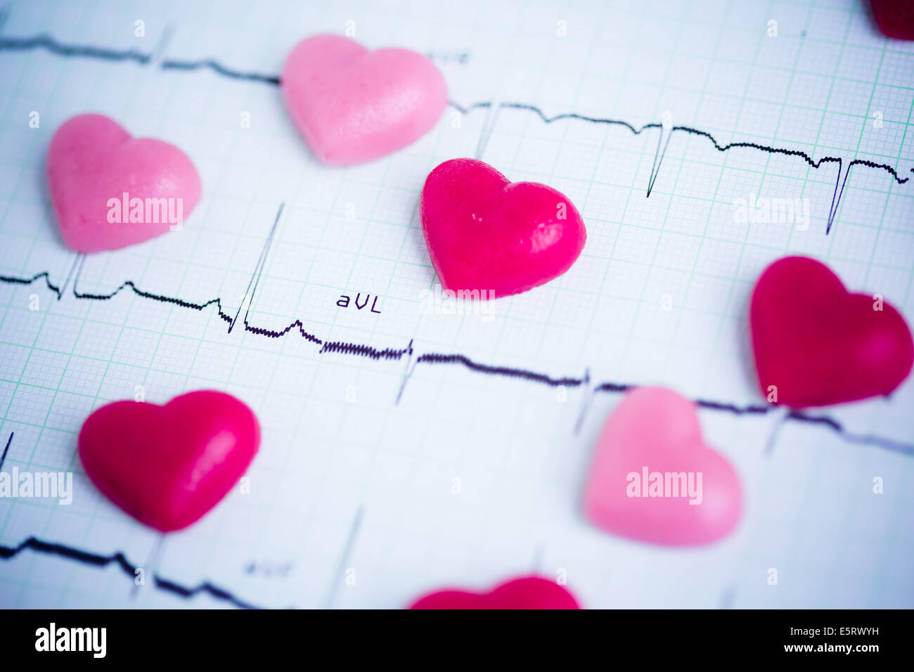 Normal ecg hi-res stock photography and images - Alamy