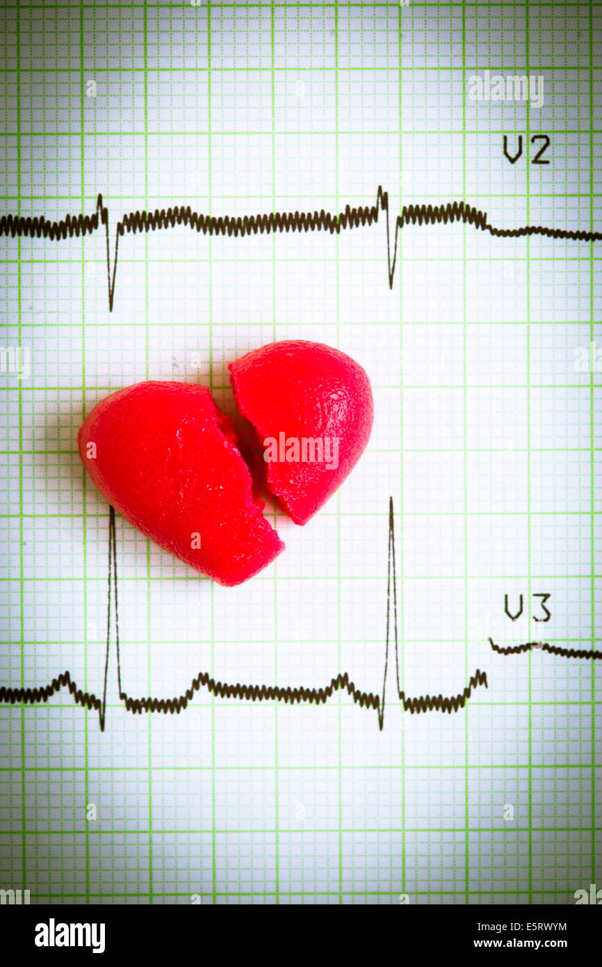 Heart attack, conceptual image Stock Photo - Alamy