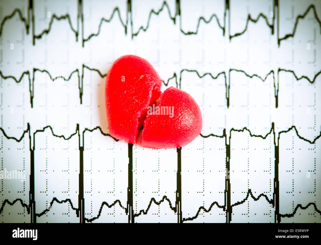 Heart attack ecg hi-res stock photography and images - Alamy