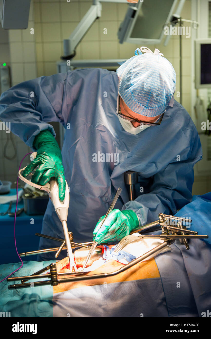 Cystectomy hi-res stock photography and images - Alamy