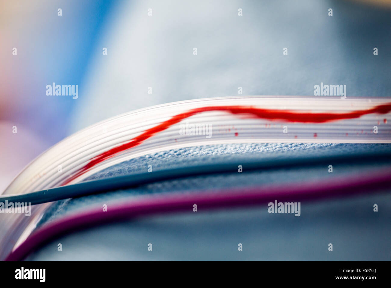 Pipe collecting blood during a surgical operation Stock Photo - Alamy