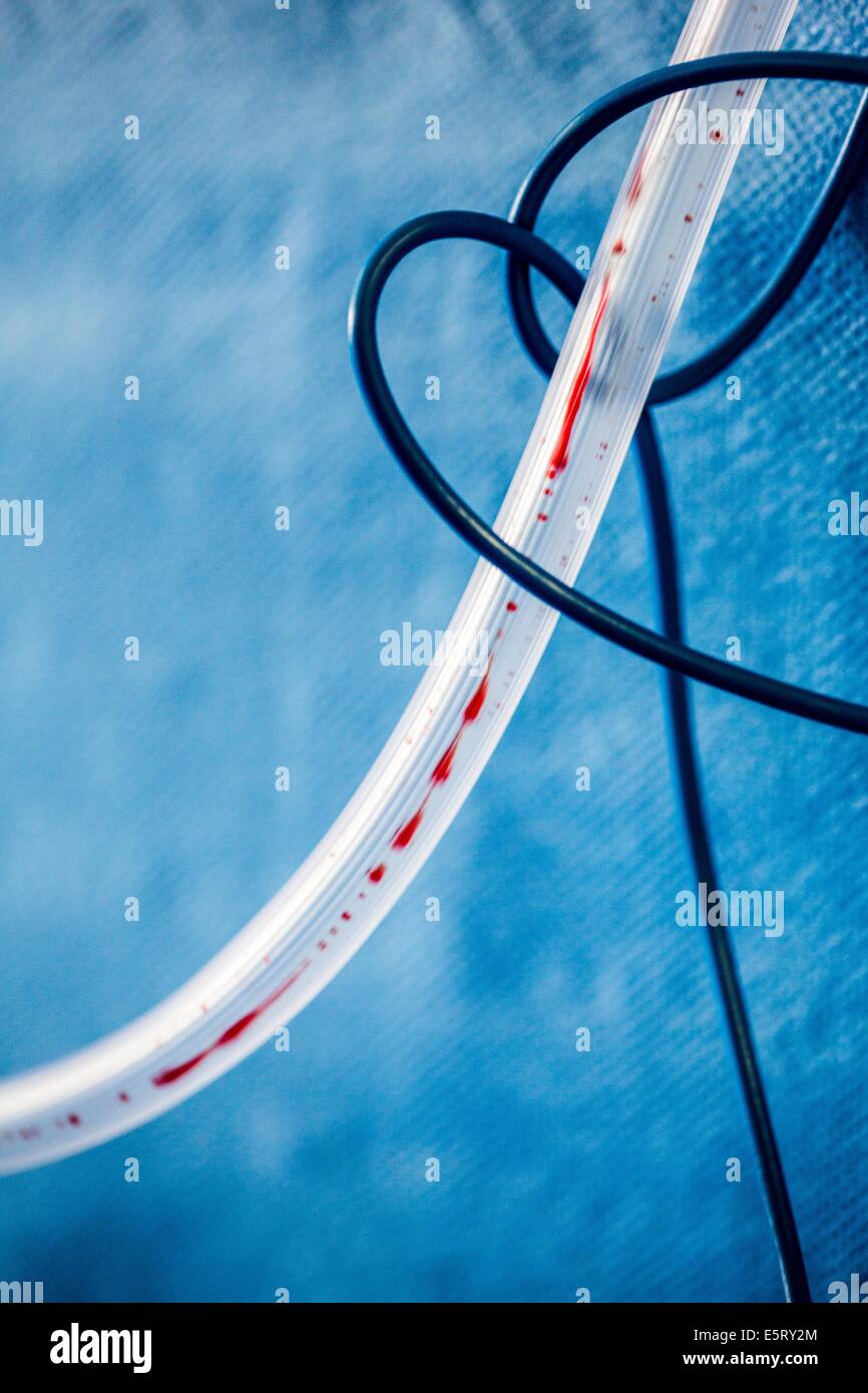 Pipe collecting blood during a surgical operation Stock Photo - Alamy