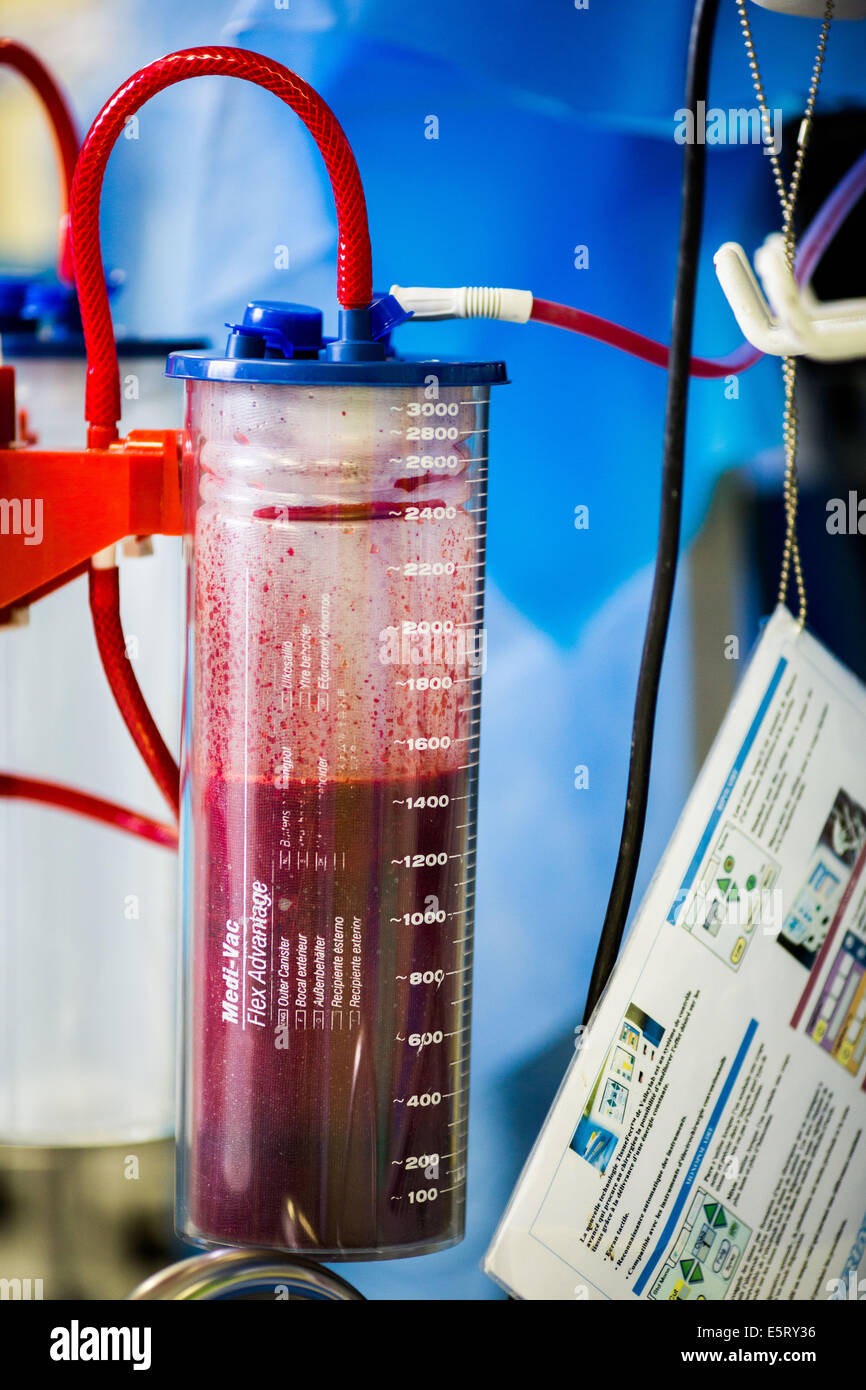 Outer canister for intraoperative blood recovery Stock Photo - Alamy