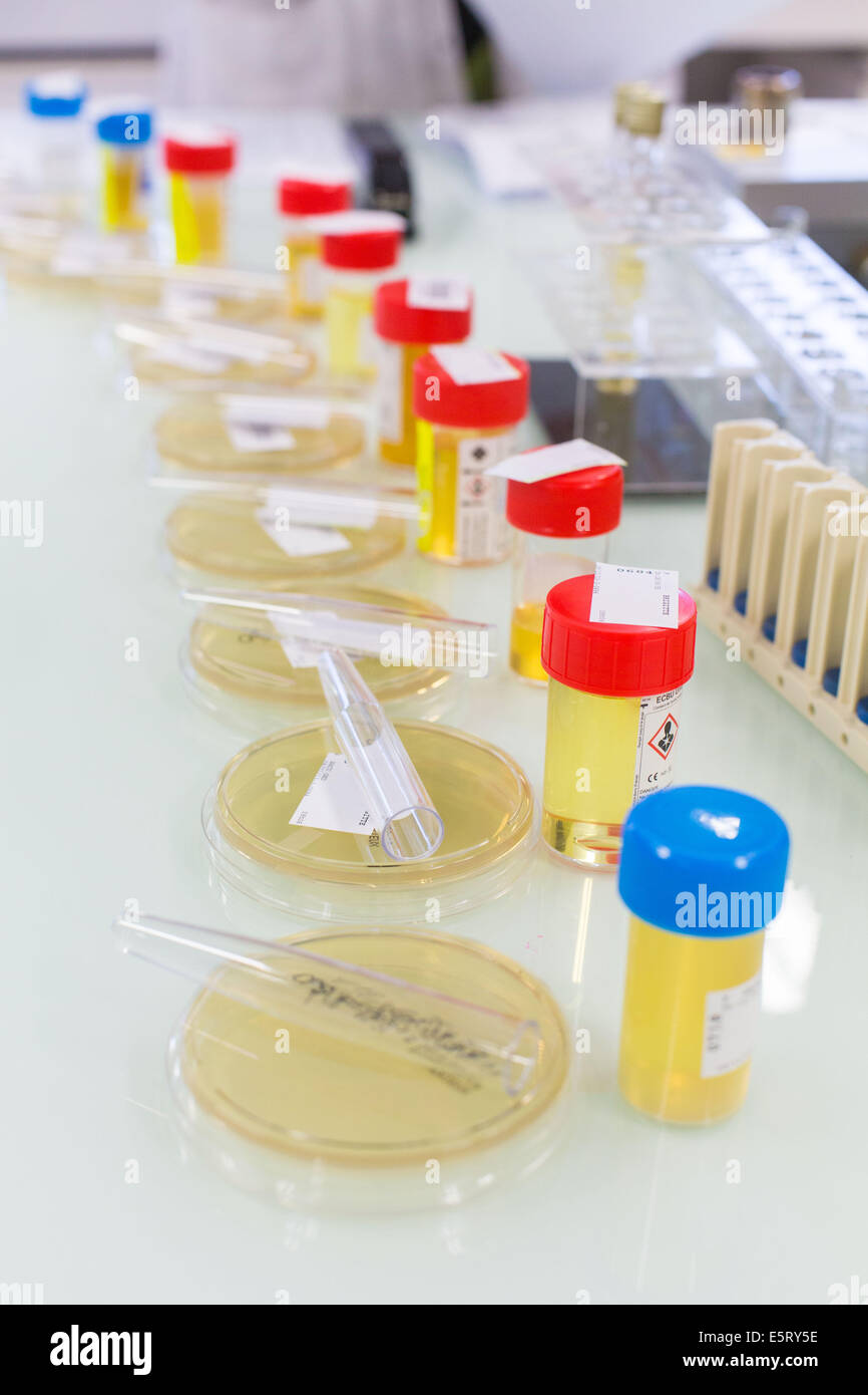 Urine samples in a medical laboratory Stock Photo - Alamy