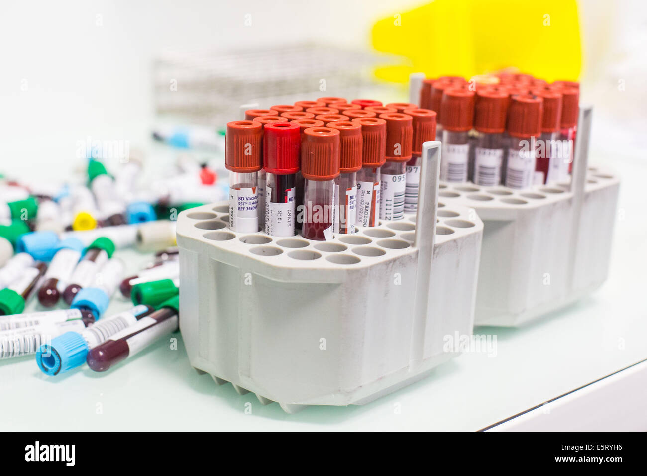 Blood samples in a medical laboratory Stock Photo - Alamy