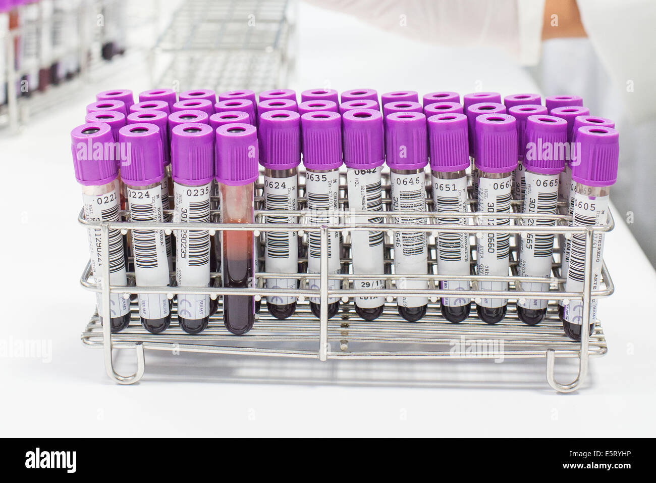 Laboratory samples hi-res stock photography and images - Alamy
