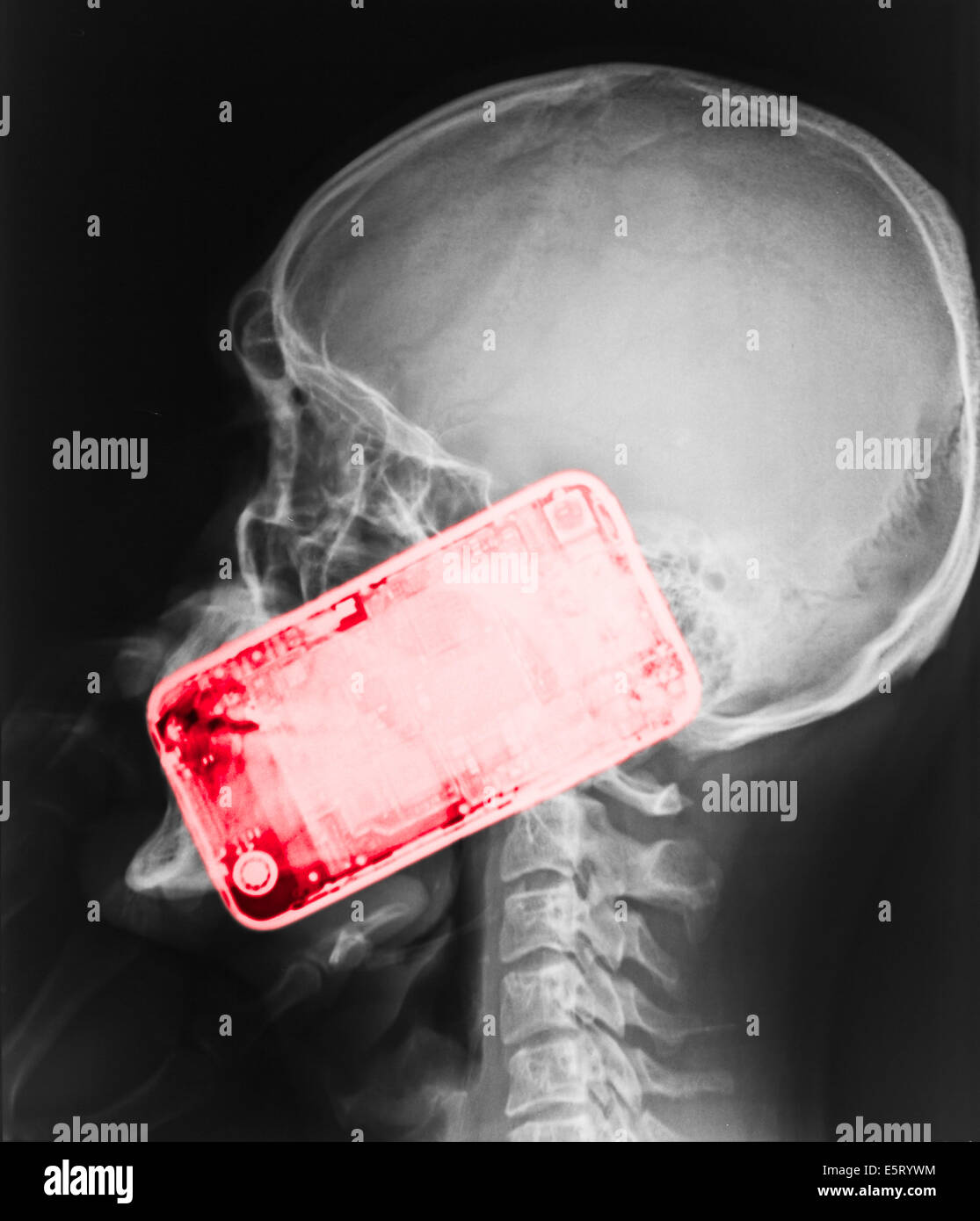Colored X-ray showing the head of a man using a smartphone. The use of ...