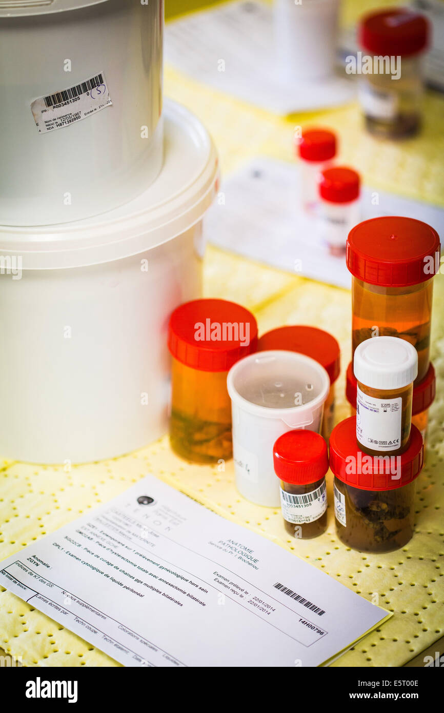 Anatomopathology diagnosis, Tenon hospital, Paris, France Stock Photo ...