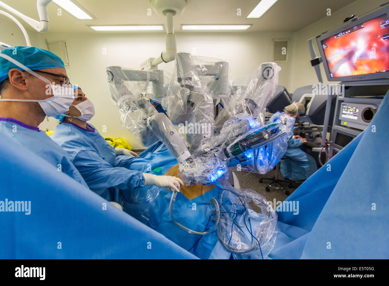 Hysterectomy performed by the telesurgery robot Da Vinci, which four ...