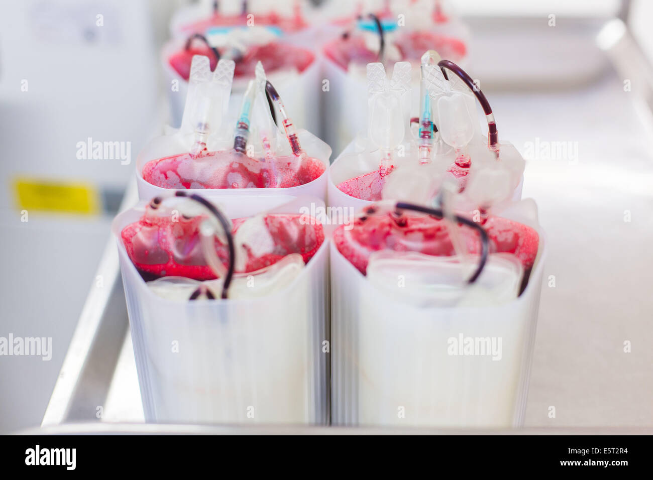 Blood bags, donor blood processing, Army Blood Transfusion Service ...