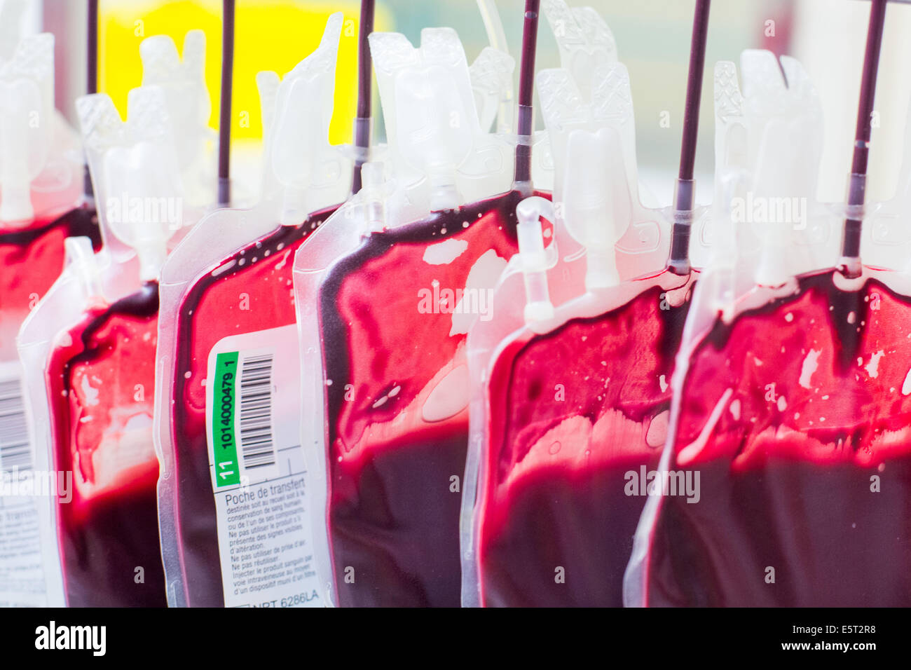 Blood bags, donor blood processing, Army Blood Transfusion Service ...