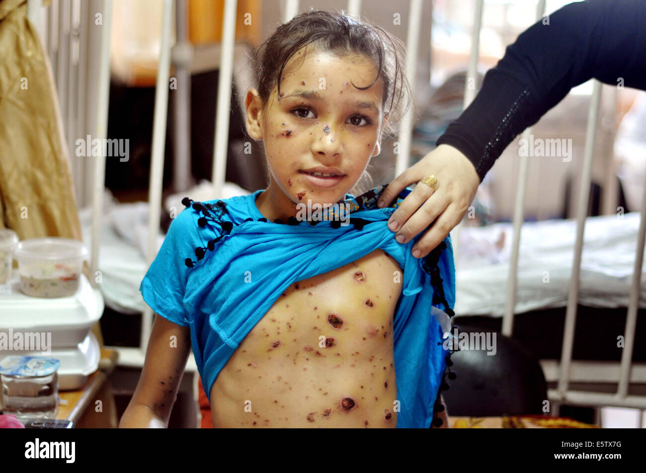 Gaza City, Gaza Strip, Palestinian Territory. 6th Aug, 2014. A ...