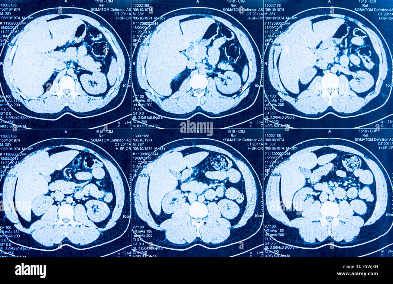 Normal ct scans hi-res stock photography and images - Alamy
