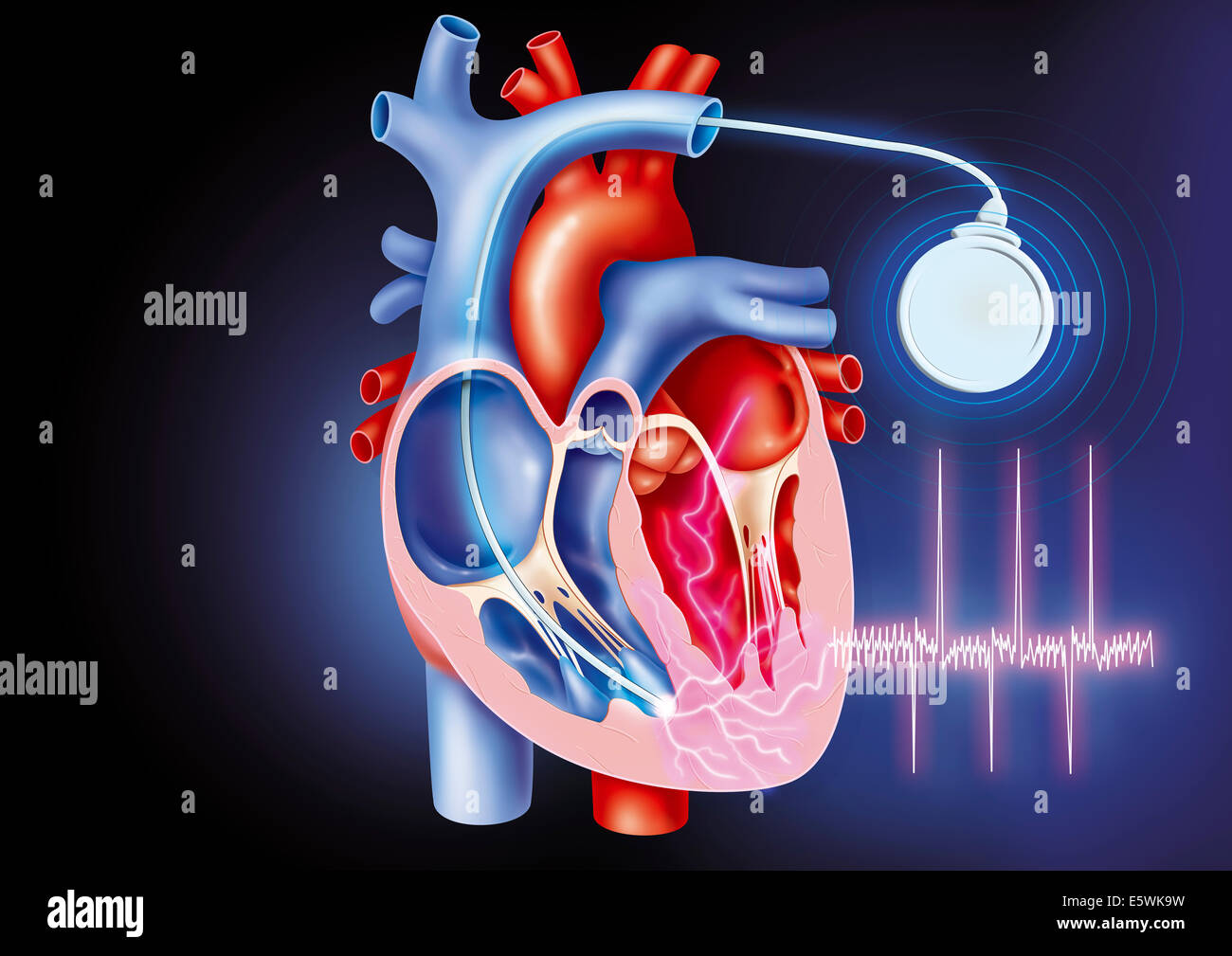 Defibrillators hi-res stock photography and images - Alamy