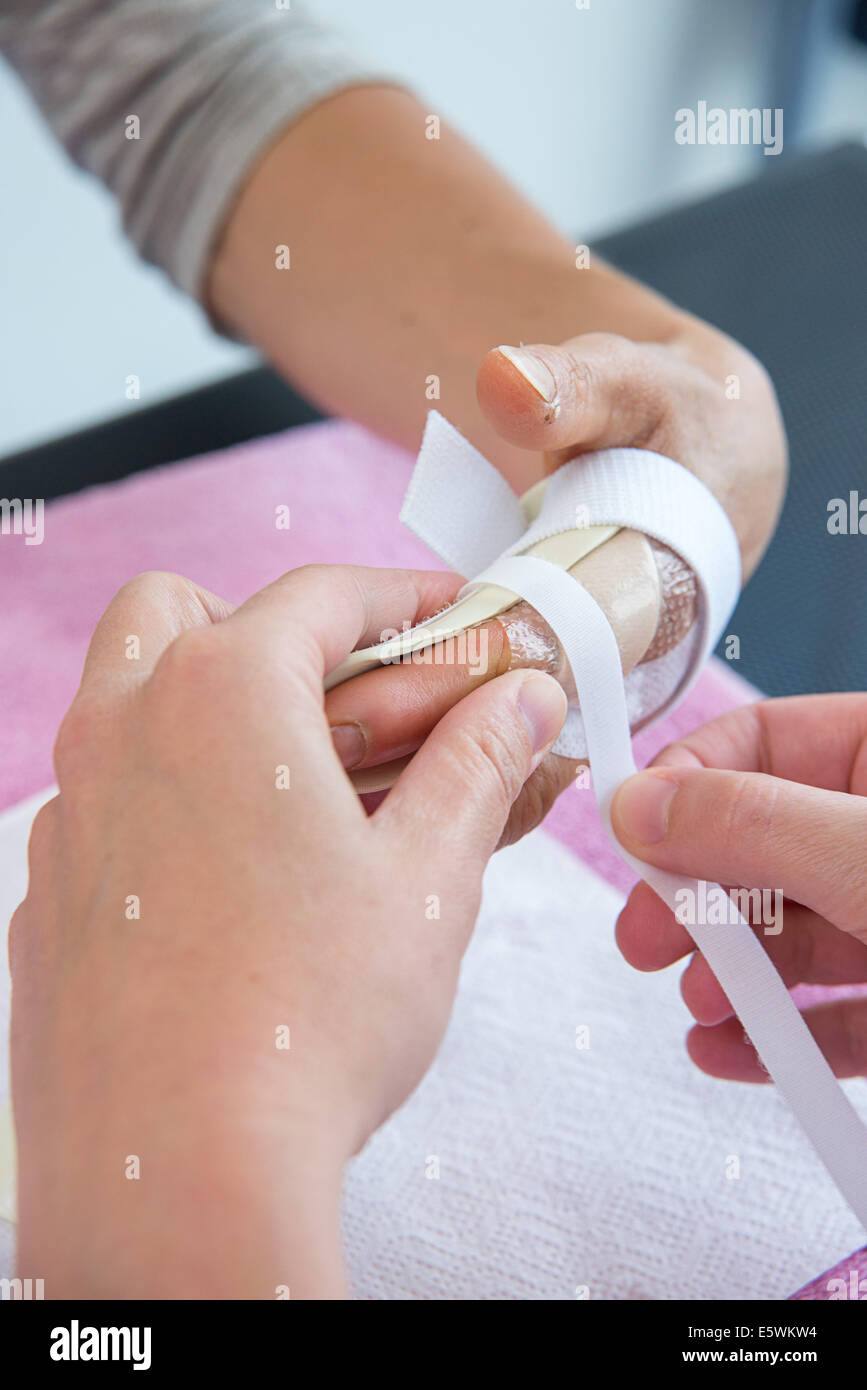 Finger splint hi-res stock photography and images - Alamy
