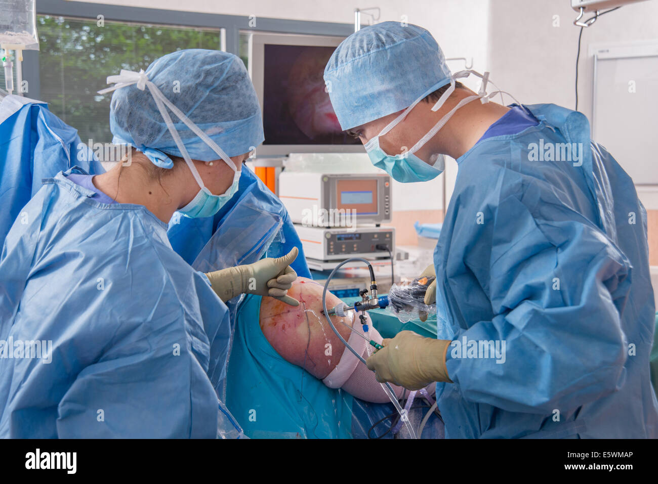 Shoulder arthroscopy hi-res stock photography and images - Alamy