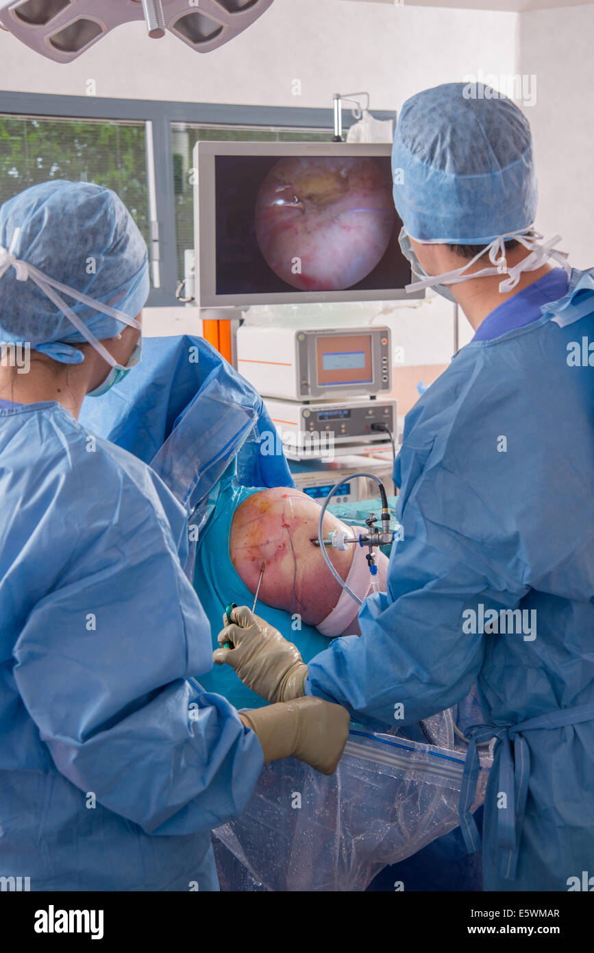 Shoulder arthroscopy hi-res stock photography and images - Alamy