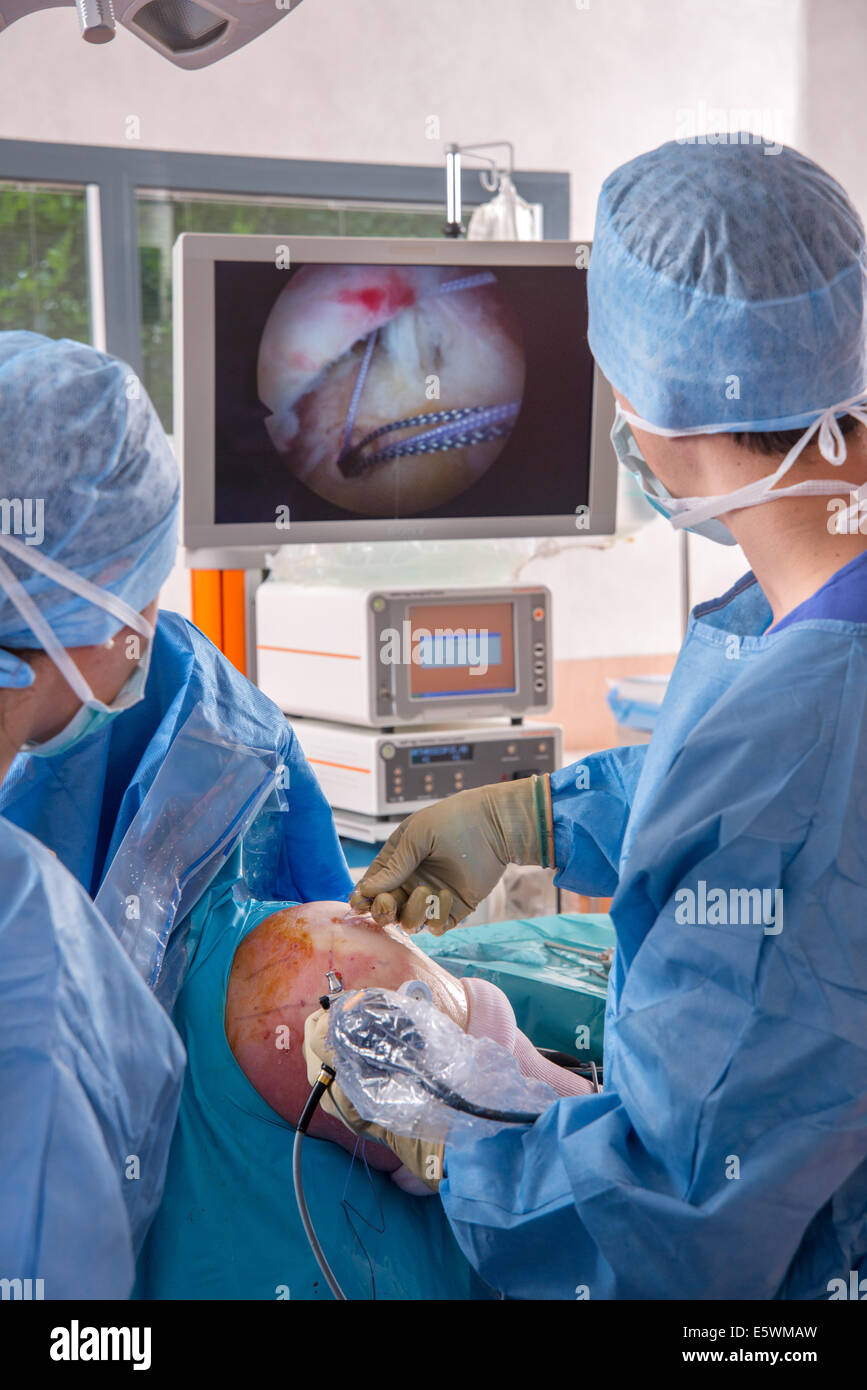Arthroscopic shoulder surgery hi-res stock photography and images - Alamy