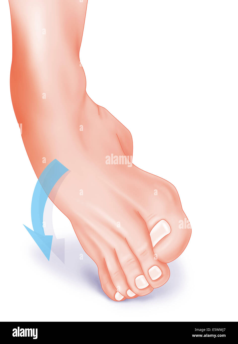 Sprained Ankle Clip Art