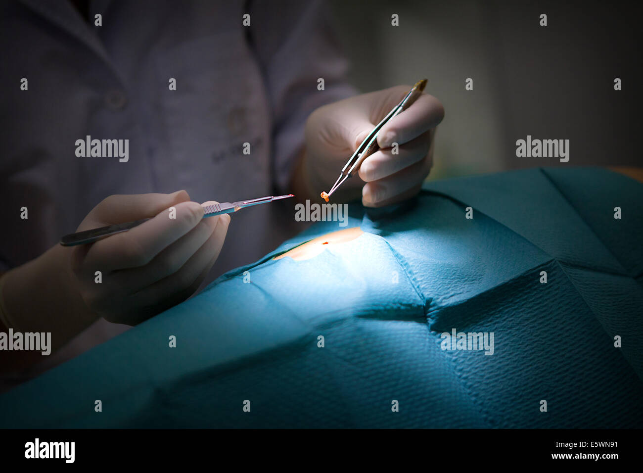 Surgery mark up hi-res stock photography and images - Alamy