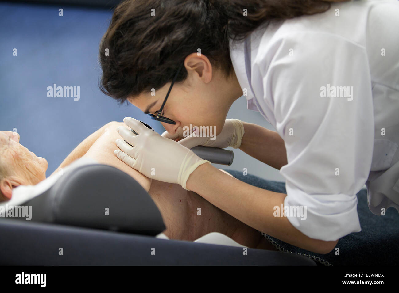 Dermatology mole arm hi-res stock photography and images - Alamy
