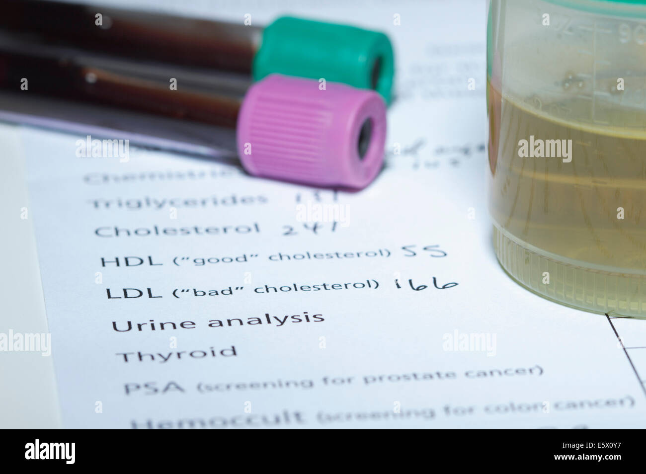 Blood tubes and urine sample on the results of tests done as part of a ...