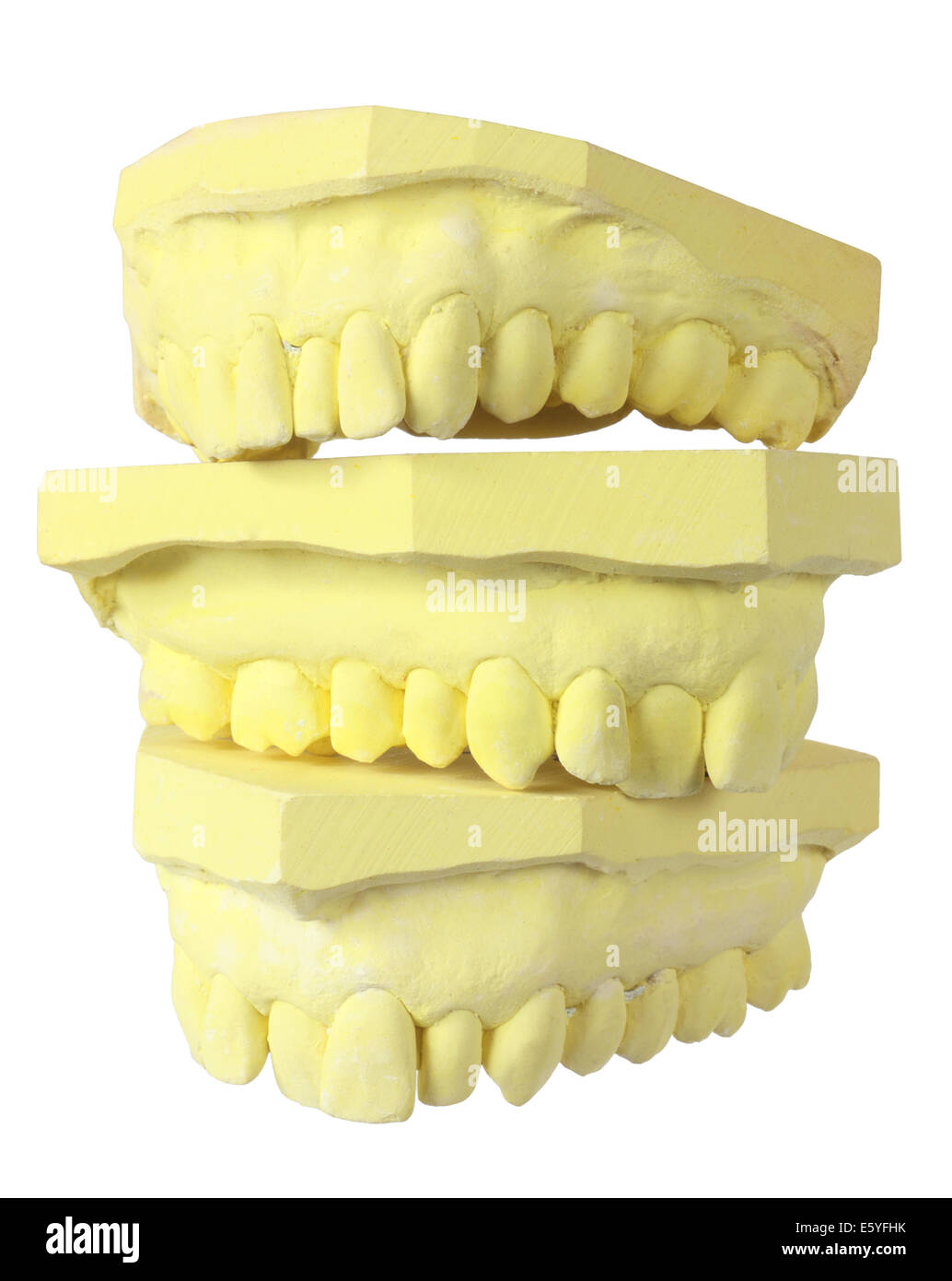 Dental mould hi-res stock photography and images - Alamy
