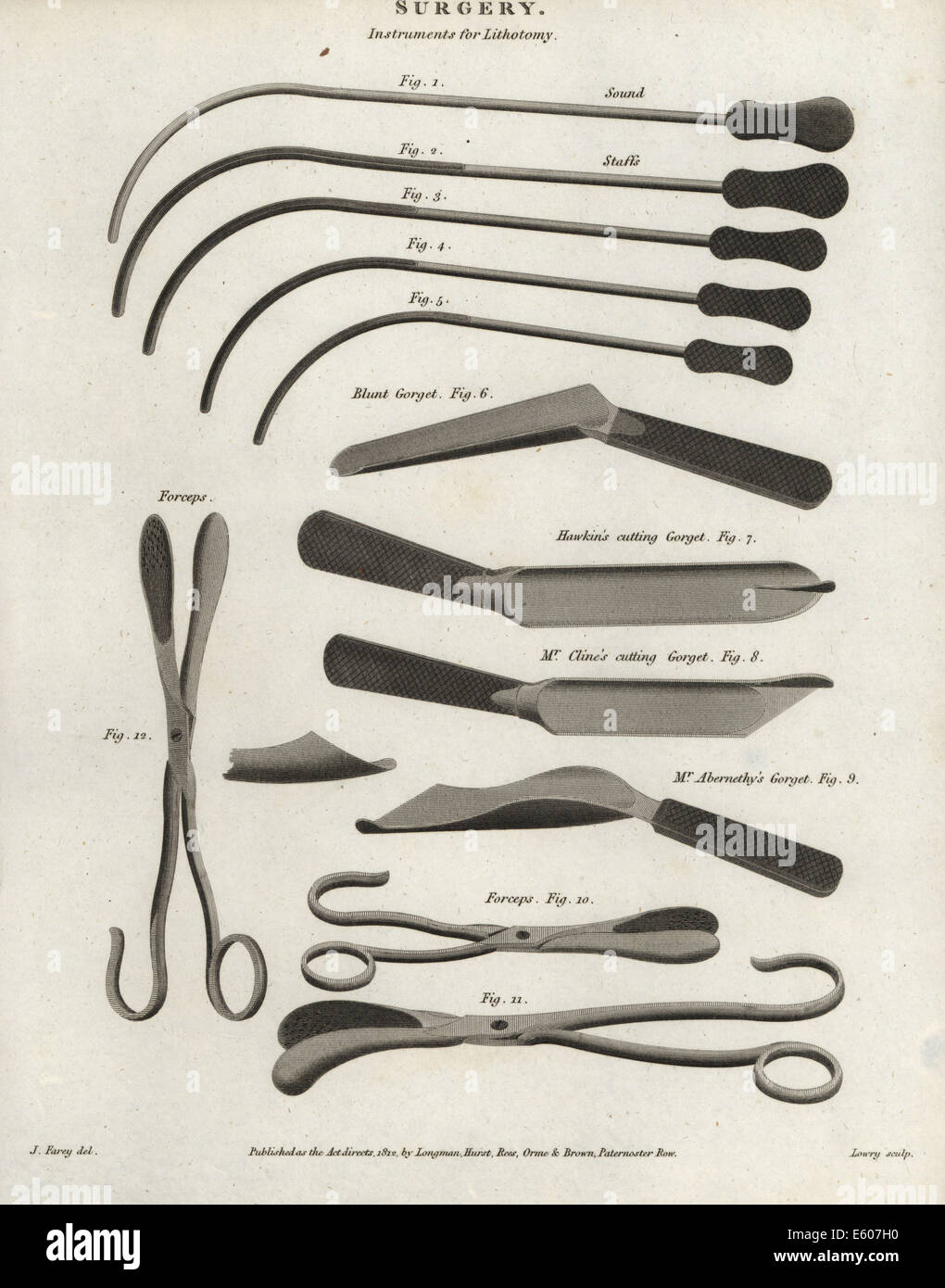 Lithotomy hi-res stock photography and images - Alamy