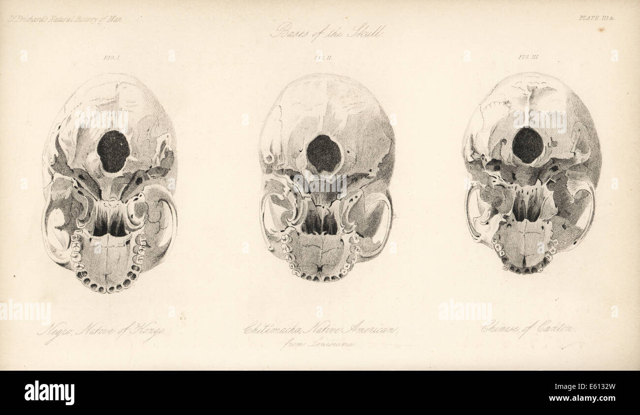 Skull bones of a native of Congo, native American and Chinese Stock ...