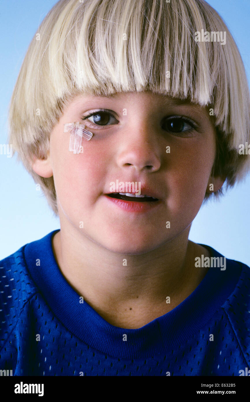 BLOND BOY WITH A CUT ON HIS CHEEK Stock Photo - Alamy