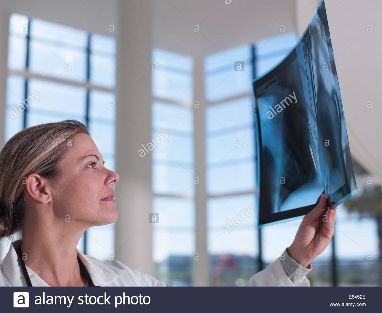 Woman X Ray Stock Photos & Woman X Ray Stock Images - Alamy
