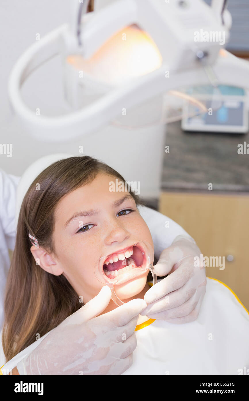 Dentist putting mouth retractor on little girl Stock Photo - Alamy
