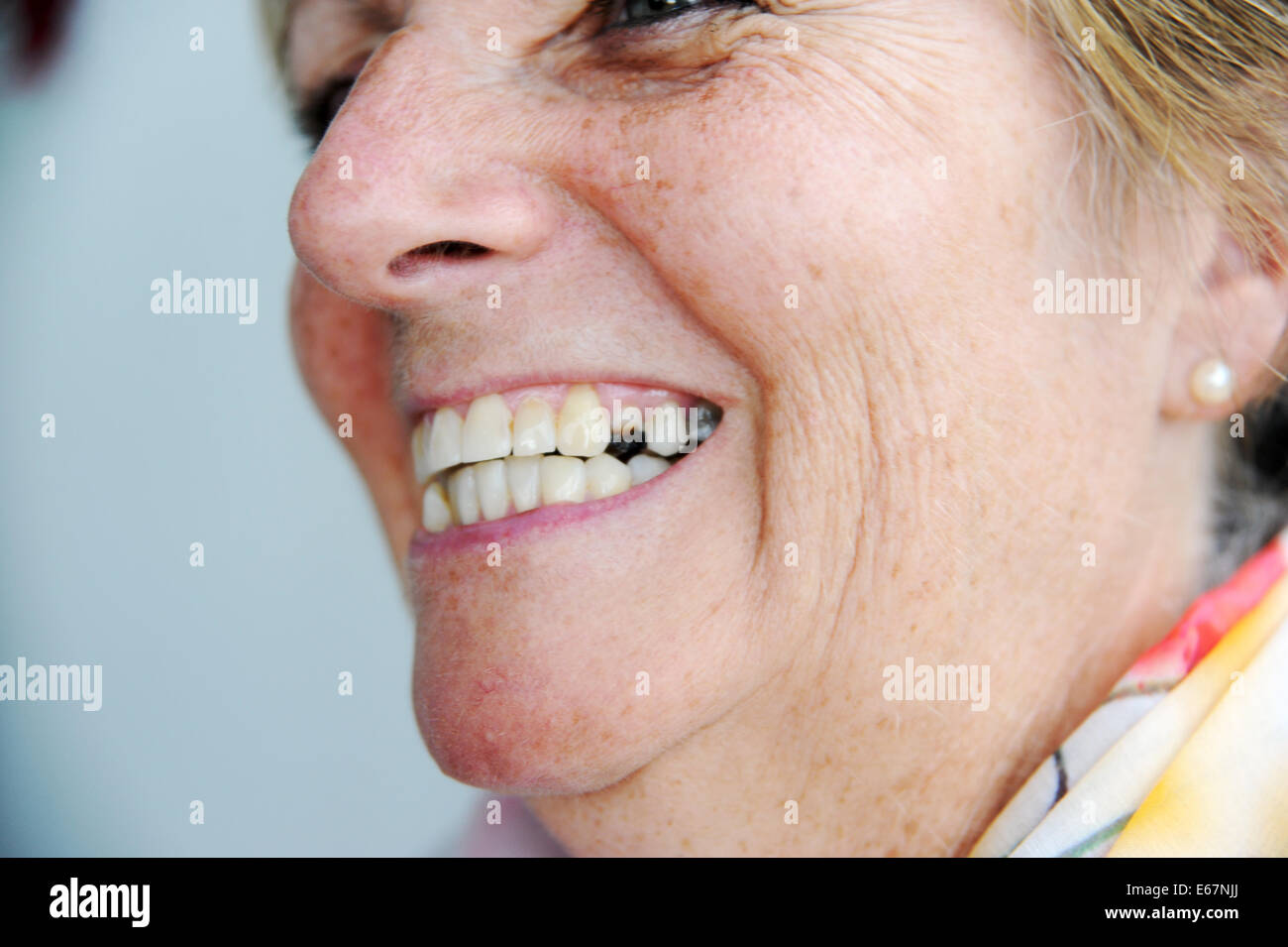 Broken tooth hi-res stock photography and images - Alamy