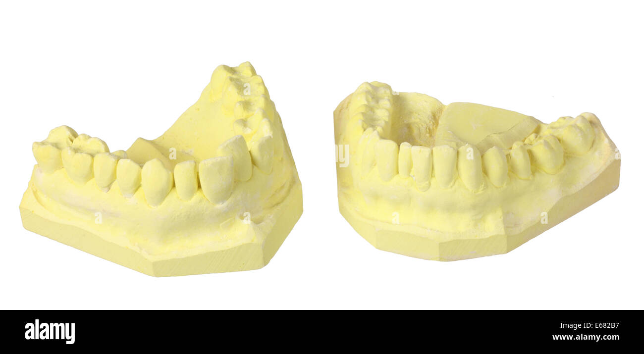 Dental mould hi-res stock photography and images - Alamy