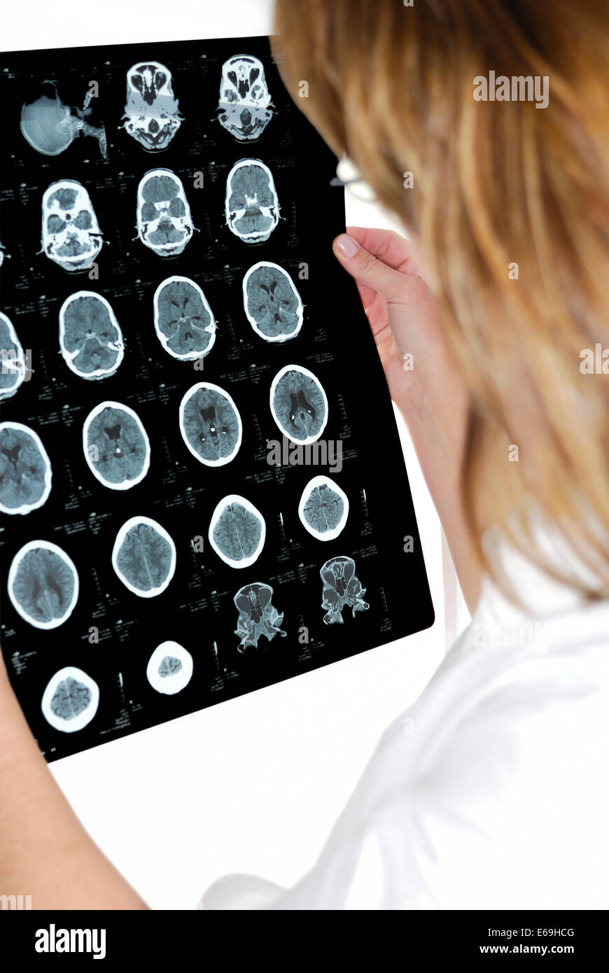 Cat brain anatomy hi-res stock photography and images - Alamy