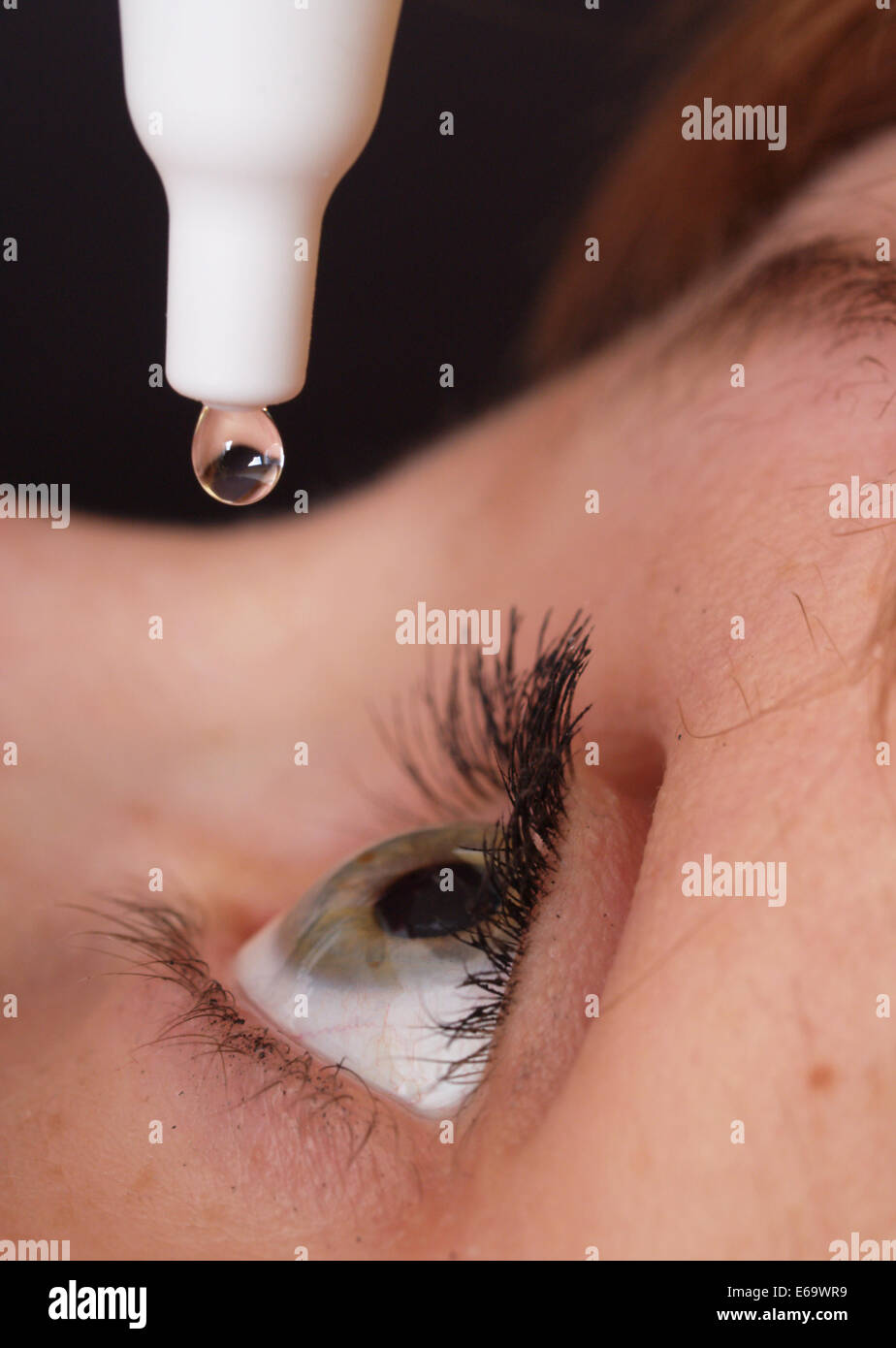 Conjunctival Sac High Resolution Stock Photography and Images - Alamy