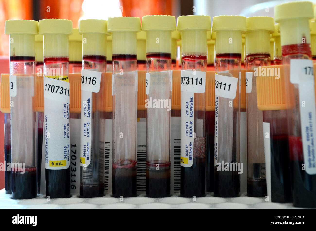 Blood samples in test tubes Stock Photo - Alamy